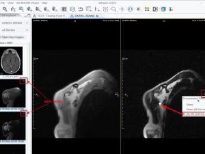 Weasis: Free DICOM viewer :: Weasis Documentation